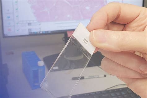 Ffpe Rna Sequencing Seqmatic