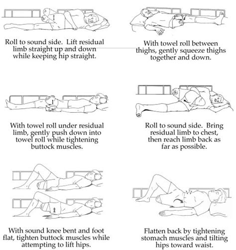 Amputee Guide Kisers Orthotics And Prosthetics Amputee Guide Kisers Orthotics And Prosthetics