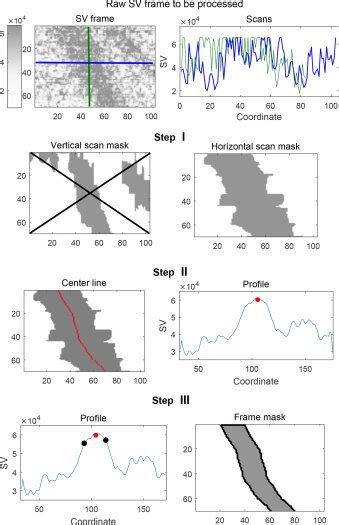 Main Steps Of The Algorithm For Diameter Estimation The Top Panel Download Scientific Diagram