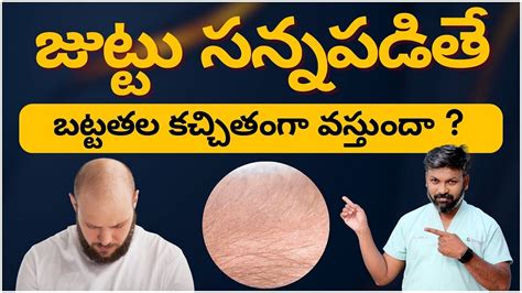 Can The Growth Of Vellus Hair Or Miniaturization Of Hair Be Triggered By Other Causes Than