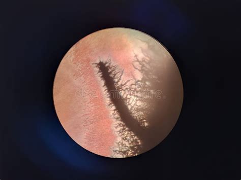 Aureobasidium Pullulans Under The Microscope Stock Image Image Of Microscope Microscopy