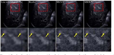 Figure 1 From A Multiscale Deep Encoderdecoder With Phase Congruency Algorithm Based On Deep
