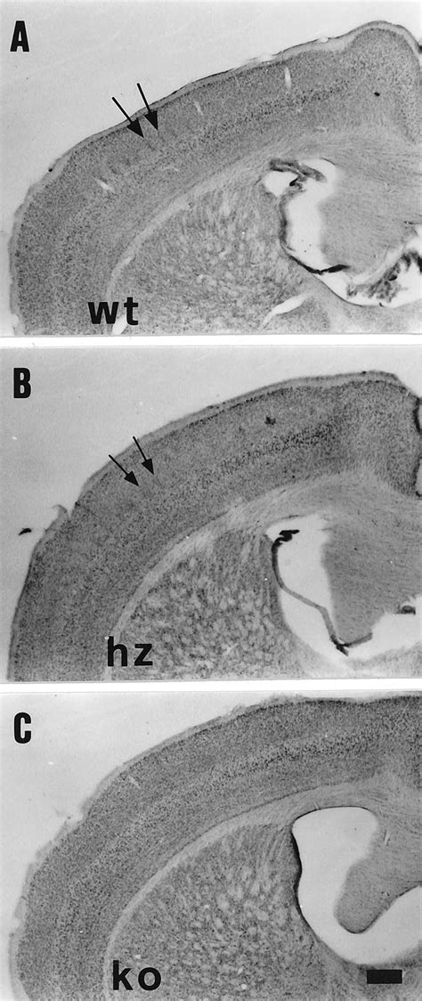 Nissl Staining Of Coronal Sections Through The Somatosensory Cortex In