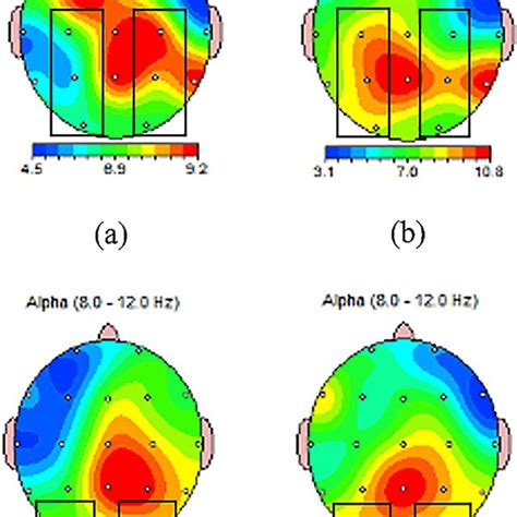 Example Brain Topographic Maps For The Visual Illusory Motion Stimulus