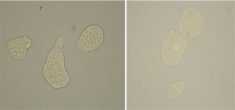Entamoeba Histolytica Trophozoites Observed Under The Microscope Stain Download Scientific