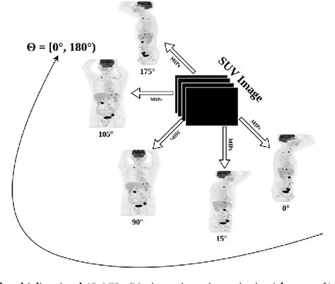 Figure 2 From Improved Automated Tumor Segmentation In Whole Body 3d