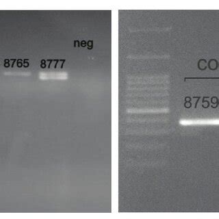 Example Of PCR Based Sex Determination Parts Of The X Linked ZFX And Download Scientific