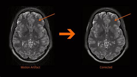 Diagnostic Imaging Technology Siemens Healthineers Usa