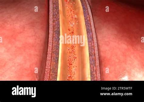 3d Human Dissection Stock Videos And Footage Hd And 4k Video Clips Alamy
