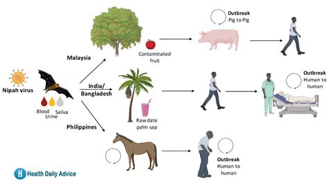 Nipah Virus What You Need To Know About The Deadly Outbreak