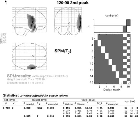 Displays The Areas Of Activation Mni Coordinates Design Matrix And