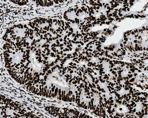 Tissue Tek Genie Rapid True Random Access Ihc Staining