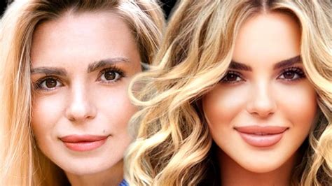 Мои Пластические Операции Youtube