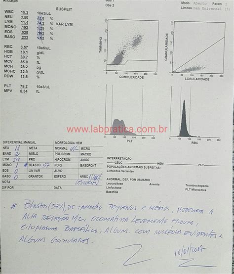 Lab Prática Paciente Sex F Id 25 Anos Hd Leucemia Aguda