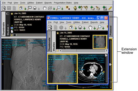 Opening An Order In An Extension Window