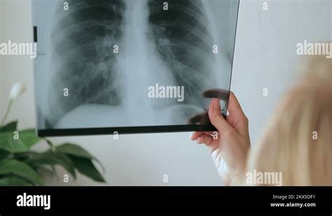 Adult Female Chest X Ray Stock Videos And Footage Hd And 4k Video Clips