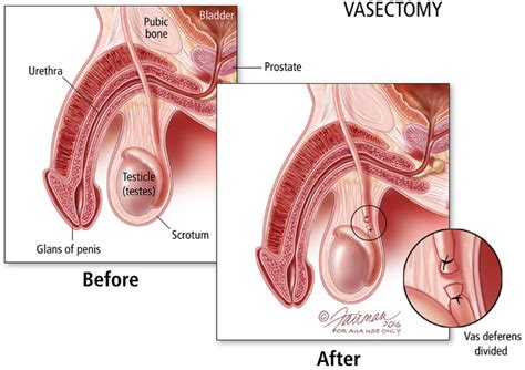 Procedures Mead Medical Kalamunda Maida Vale