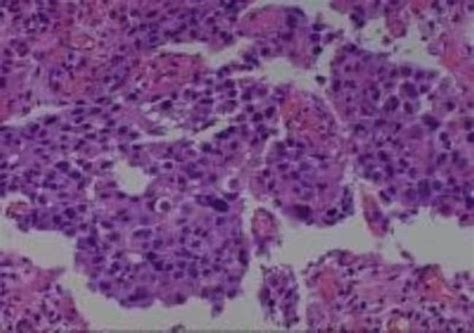 Novus Biologicals Human Multi Tissue Tissue Microarray Cancer Human