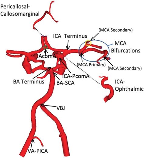 Cerebral Aneurysm Neurosurgery Blog