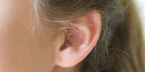 Dr Pimple Popper Posts Gauged Earlobe Repair Before And After Photos