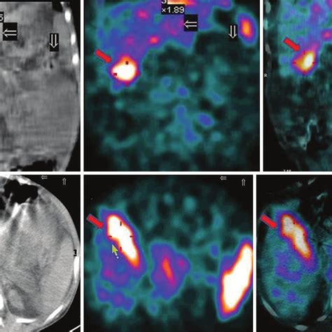 SPECT CT Images Of The Abdomen Coronal Images A CT B SPECT C Download Scientific Diagram