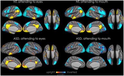 Statistical Maps Of Differences In Fmri Activation For Each Group For