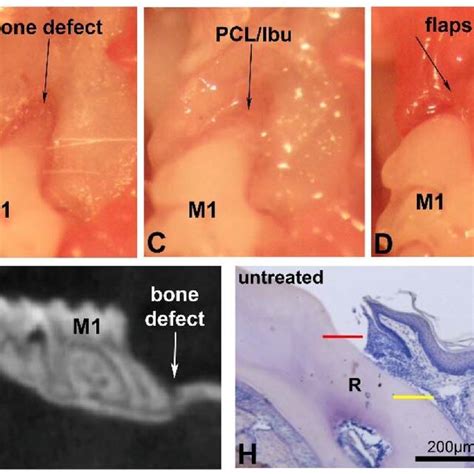 Surgical Bone Defect Model And Treatment With Pcl Ibu Membrane A I