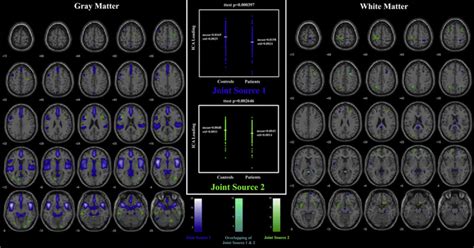 Joint Source 1 And Joint Source 2 Discovered By JSBM Xu Et Al 2009b Download High