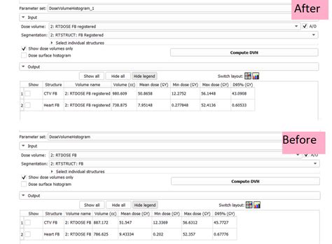 Dvh Variations After Deformable Registration Support 3d Slicer