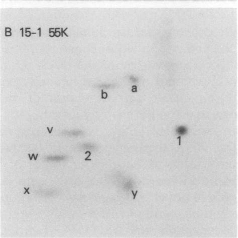 Fluorogram Of Acrylamide Gel Electrophoresis Of 35smethionine Labeled