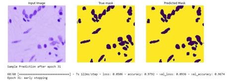 Hazirah Mohd Rafidi On Linkedin Deeplearning Data Computervision