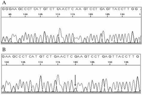 Kit Gene Mutation In Exon 13 A Wild Type B Dna Sequence Of A Download Scientific Diagram