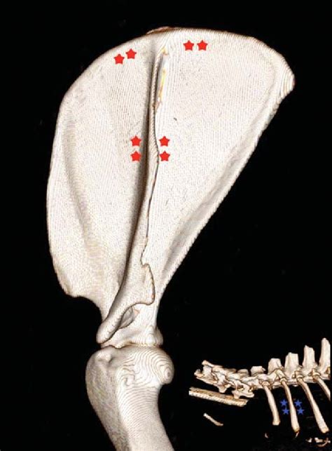 Three Dimensional Computed Tomography Reconstruction Showing The Left