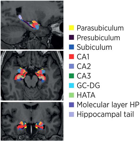 Parietal Memory Network And Memory Encoding Versus Retrieval
