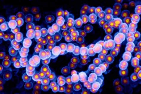 Strep A What Are The Symptoms How Dangerous Is It…