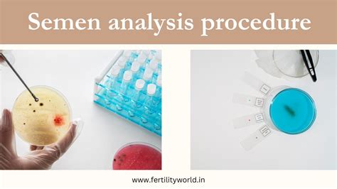 Semen Analysis Procedure Semen Analysis Sperm Count
