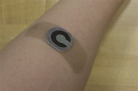 Non Invasive Glucose Monitoring For People With Diabetes The Pharmaceutical Journal