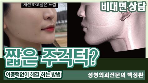 Sub 짧은 주걱턱 이중턱없이 해결하는 방법 비대면상담 253 How To Fix A Short Witchs Chin Without A Double Chin