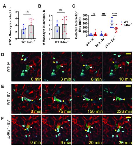 Tumor Cell Macrophage Interaction In The Pulmonary Metastatic Site In Download Scientific