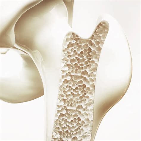 Bone Density For Winter Park Orlando And Lake Mary Fl University Diagnostic Institute