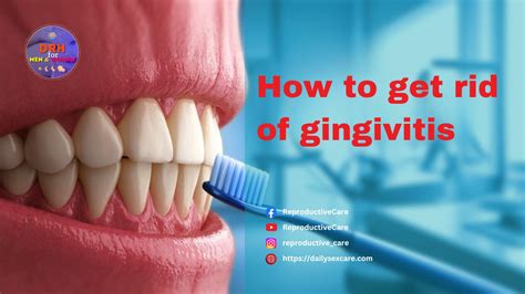 How To Get Rid Of Gingivitis Reproductive Health