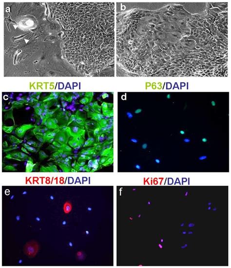 Characterization Of Primary Culture Of Human Keratinocytes In Vitro Download Scientific