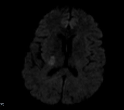 Stroke Classification Dataset By Stroke
