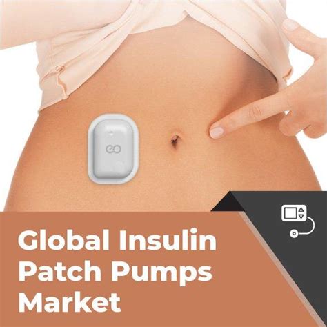Insulin Patch Pumps Market Ml And Ai Transforming Diabetes Care For