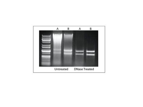 Dna Extraction Rna Contamination At Jayne Griffin Blog