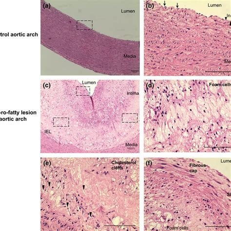 Representative H And E Stained Cross Sections Of A Normal Aortic Arch Download Scientific Diagram