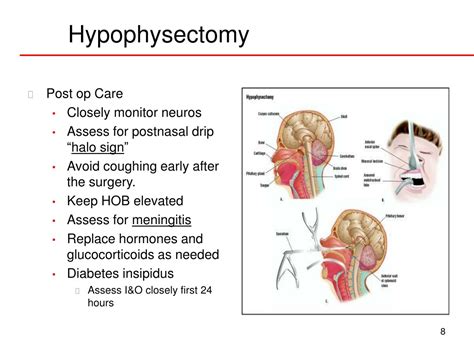 Ppt Nursing Care And Interventions In Clients With Pituataryadrenal Gland Disorders Powerpoint Ppt Nursing Care And Interventions In Clients With Pituataryadrenal Gland Disorders Powerpoint