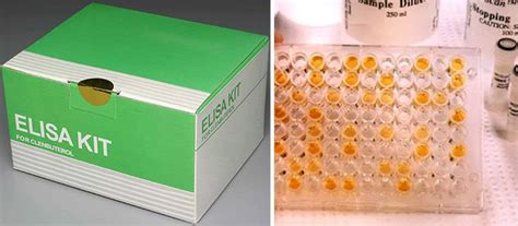 Why Have Diverse Colors In ELISA Experiment ANTITECK