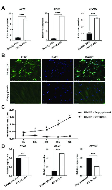 Microarray Gene Profiling And In Vitro Assay Of Hpdlf Cells A