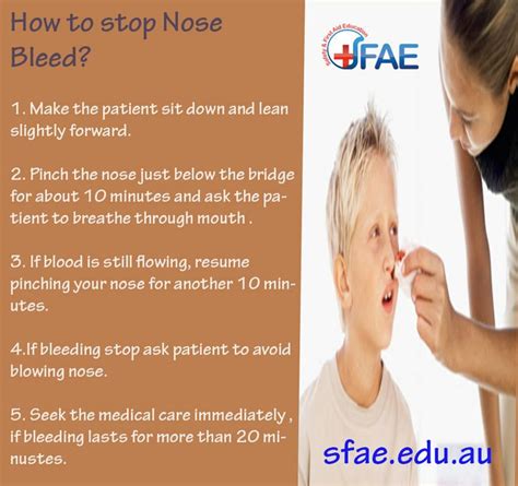 How To Stop Nose Bleed Sfae Edu Au Nose Bleeds Stop Nose Bleeds First Aid Treatment